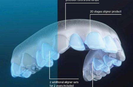Align Technology launches new Invisalign Moderate Package in Middle ...