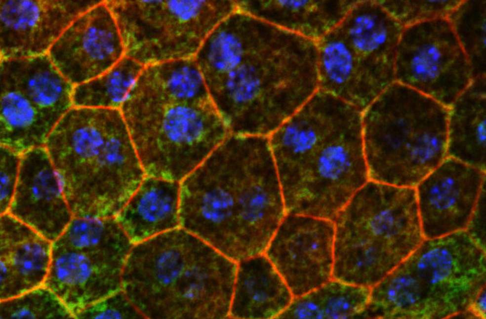 Boosting ‘Good Cholesterol’ molecule could help prevent vision loss ...