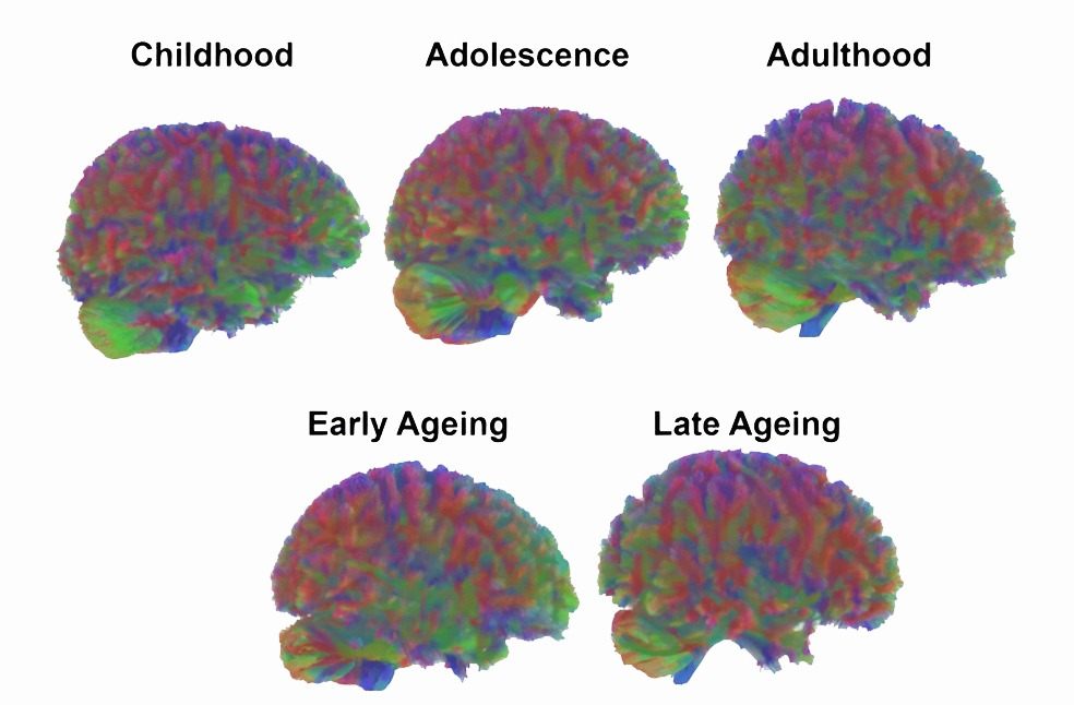 Brain shows five major turning points across human lifespan